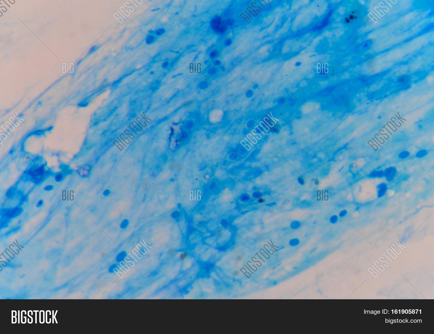 Pseudohyphae On Microscope