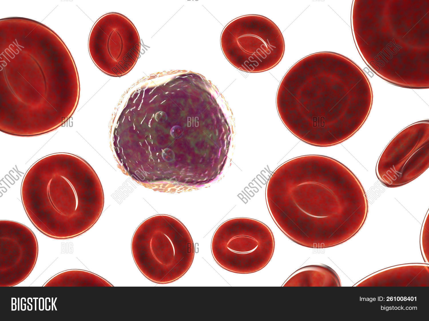 Lymphoblast, Immature Image & Photo (Free Trial) | Bigstock