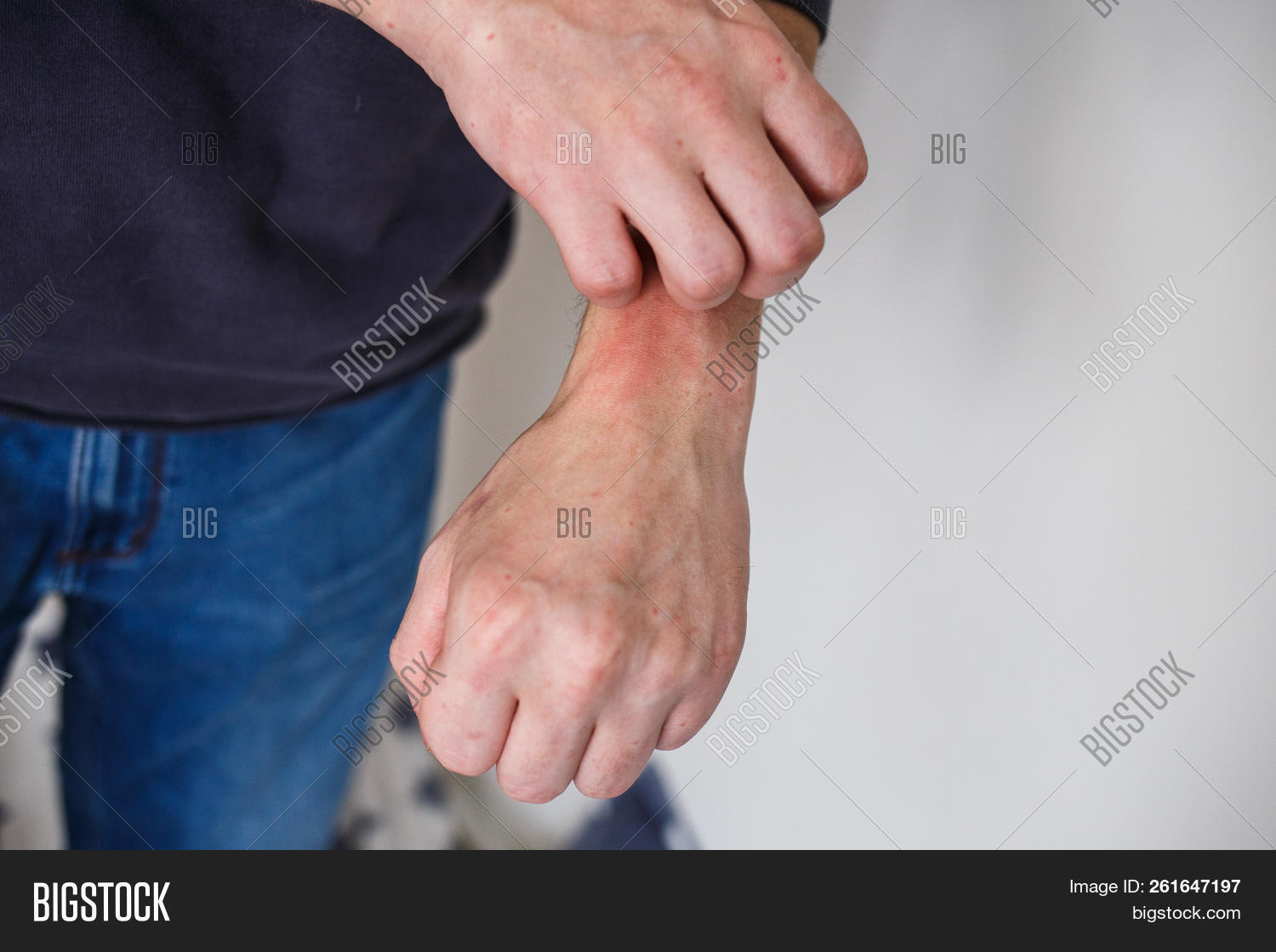 Closeup Men Itching Image & Photo (Free Trial) | Bigstock