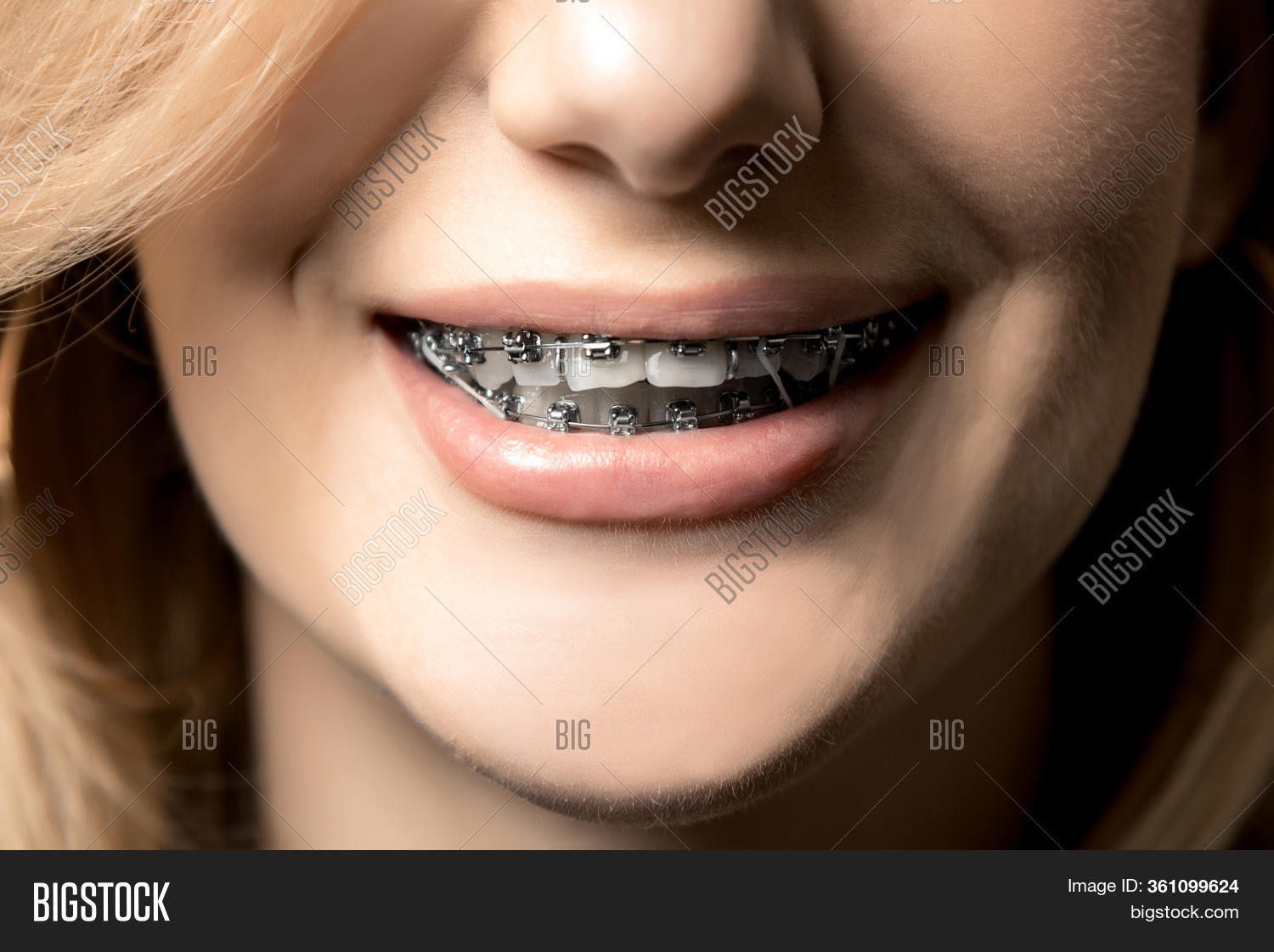 Close- Girl's Teeth Image & Photo (Free Trial) | Bigstock