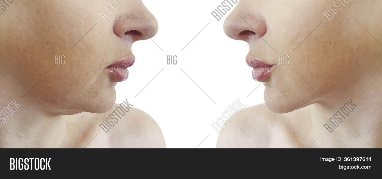 Woman Double Chin Image & Photo (Free Trial) | Bigstock