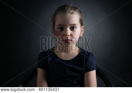 Little Girl Bruises On Image & Photo (Free Trial) | Bigstock