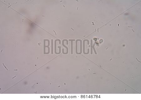 Bacteria Urine Human, Image & Photo (Free Trial) | Bigstock