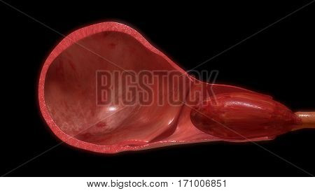 Uterine Inversion Image & Photo (Free Trial) | Bigstock