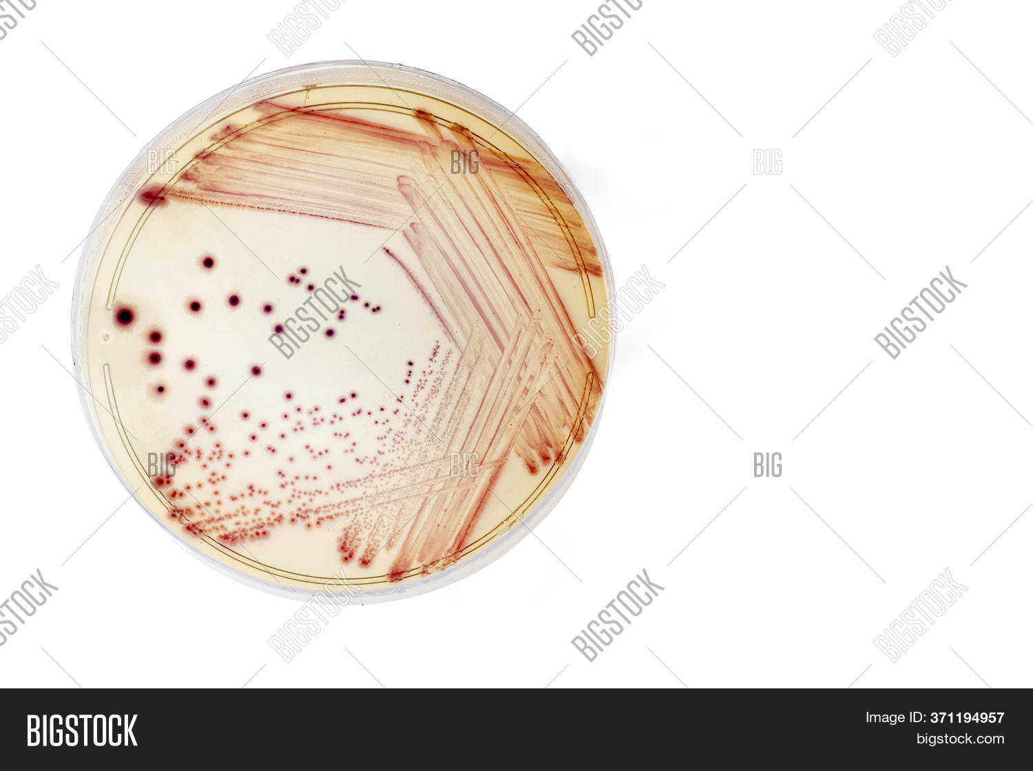 Escherichia Coli - Image & Photo (Free Trial) | Bigstock