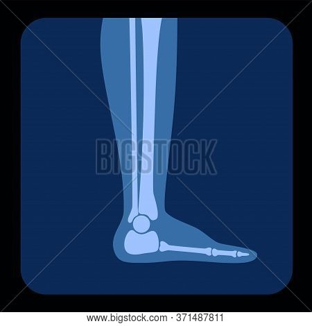 Human Leg Ankle Bones Vector & Photo (Free Trial) | Bigstock