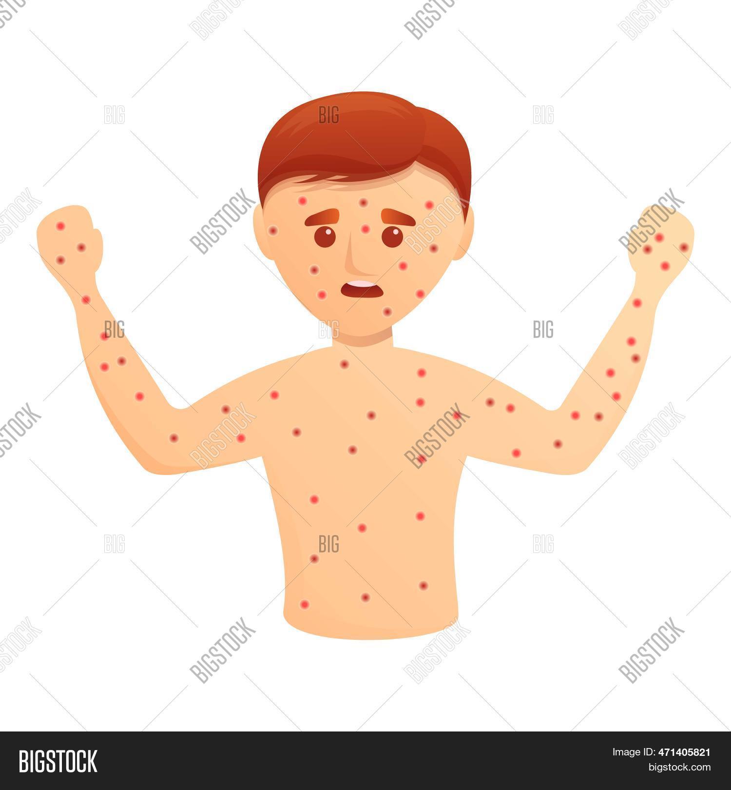 Boy Skin Rash Icon. Image & Photo (Free Trial) | Bigstock
