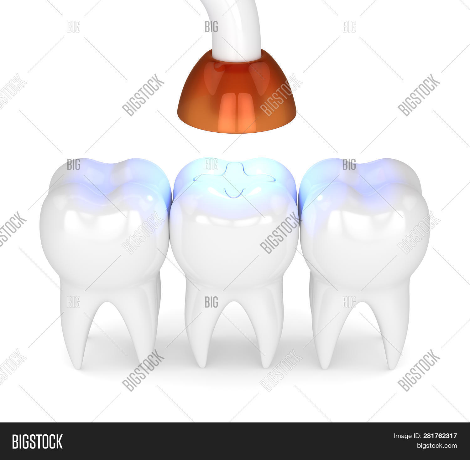 3D Render Teeth Dental Image & Photo (Free Trial) | Bigstock