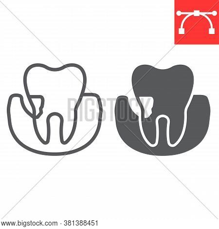 Periodontitis Line Vector & Photo (Free Trial) | Bigstock