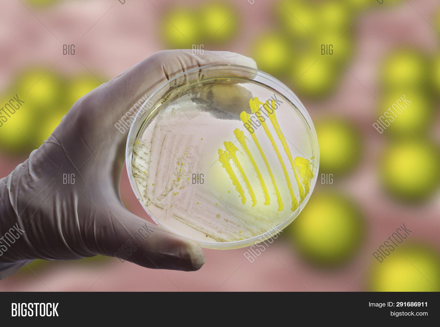 Colonies Micrococcus Image & Photo (Free Trial) | Bigstock