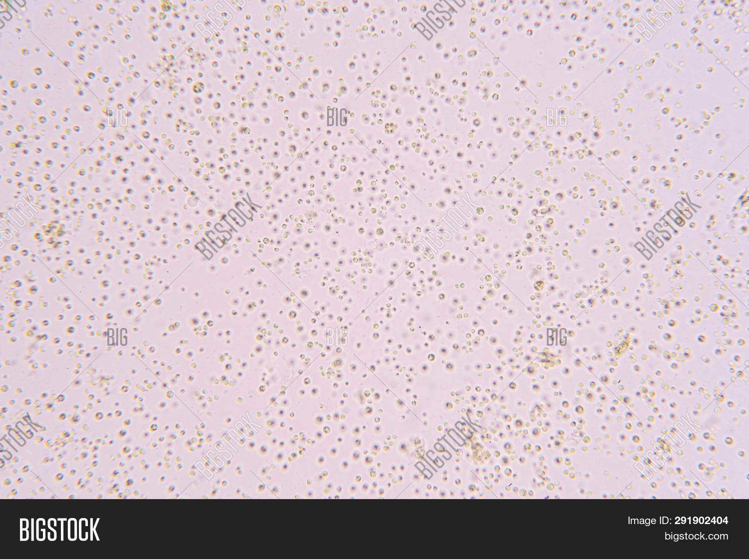 Imagen y foto Chlorella Genus (prueba gratis) | Bigstock
