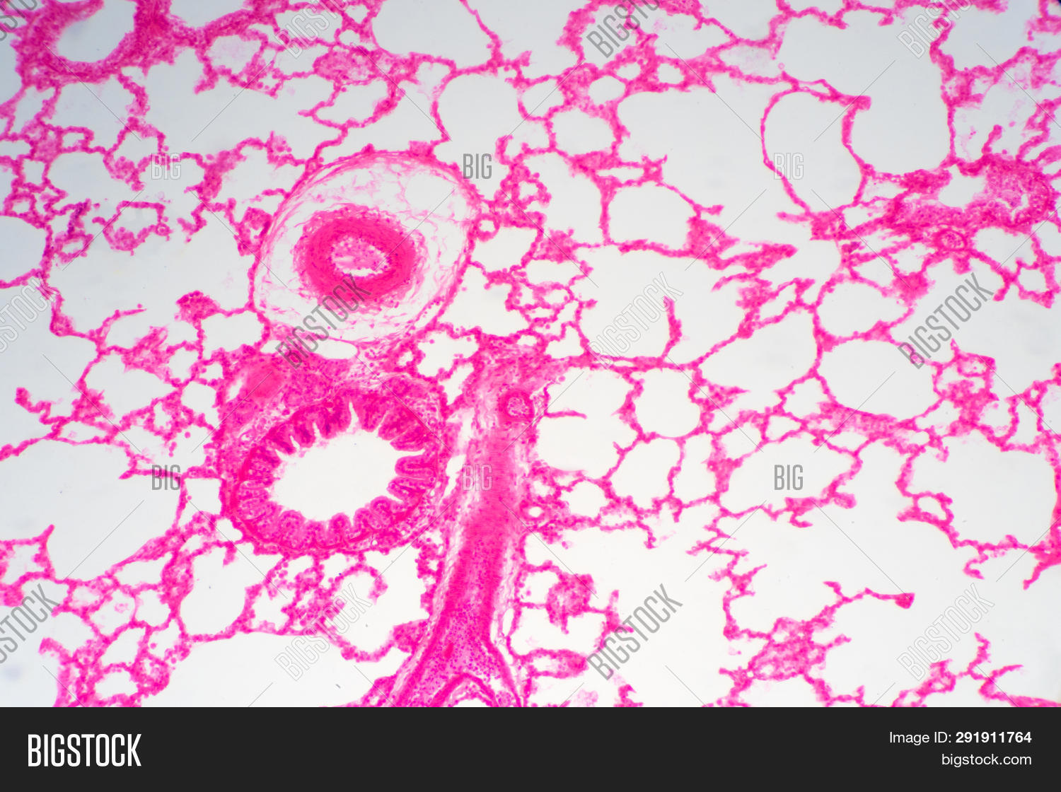 Human Lung Tissue Image & Photo (Free Trial) | Bigstock