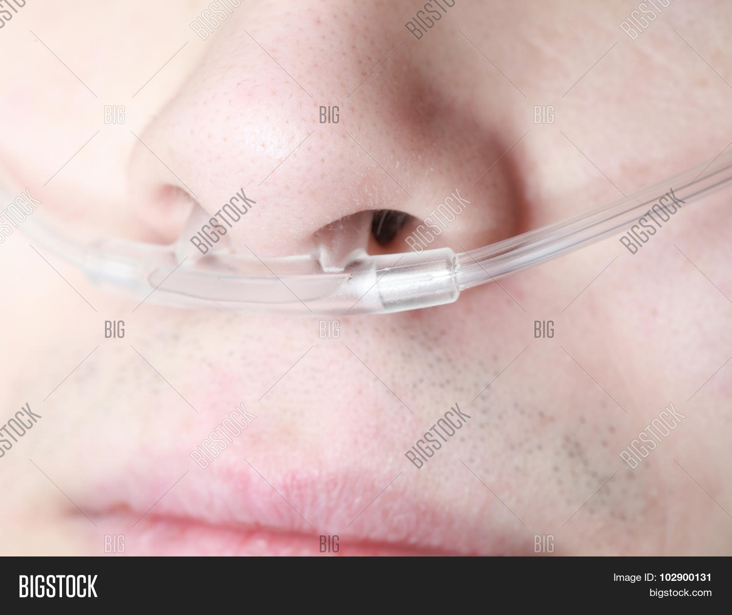 Oxygen Lines Nose Image & Photo (Free Trial) | Bigstock