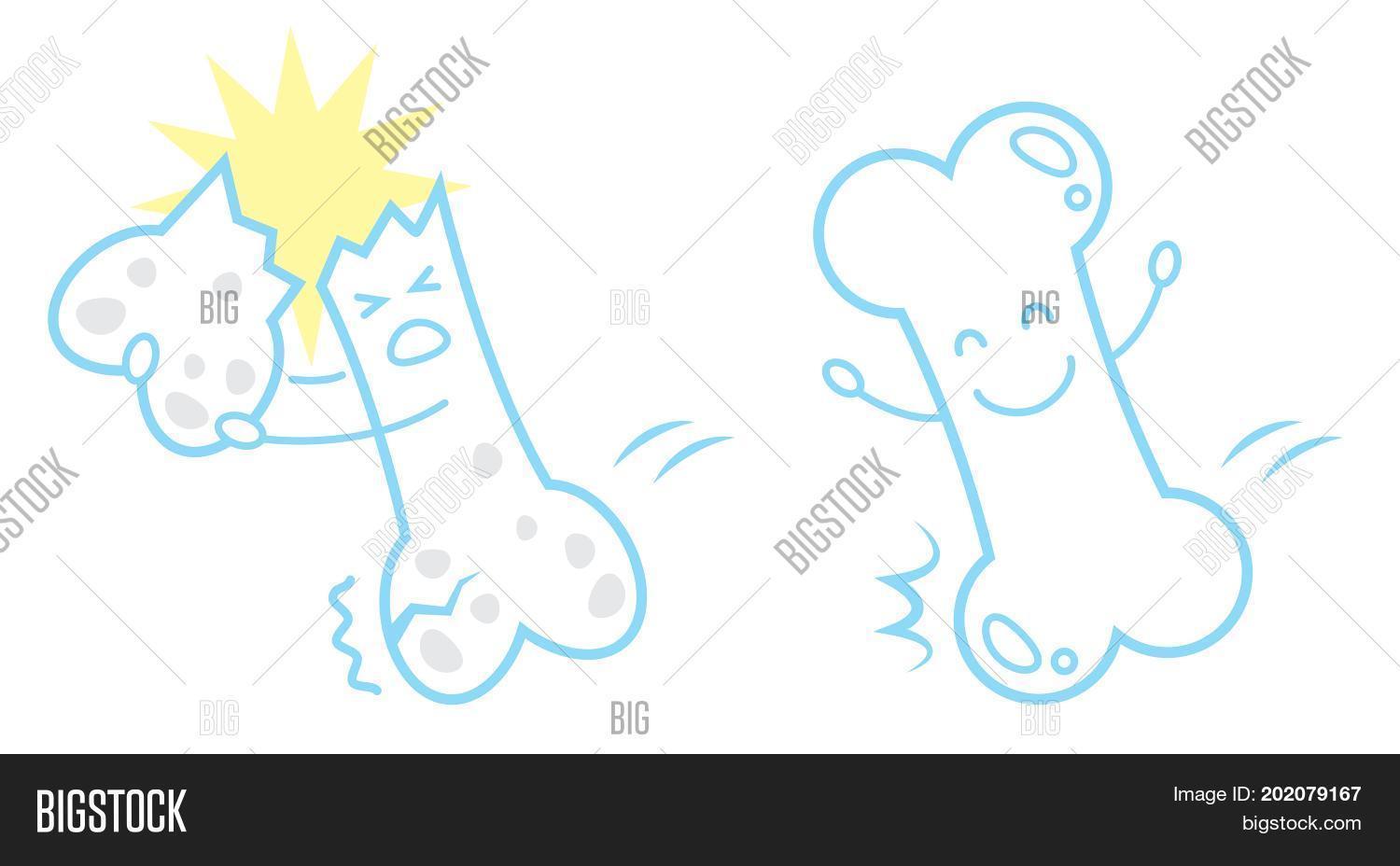 Healthy Bone Image & Photo (Free Trial) | Bigstock