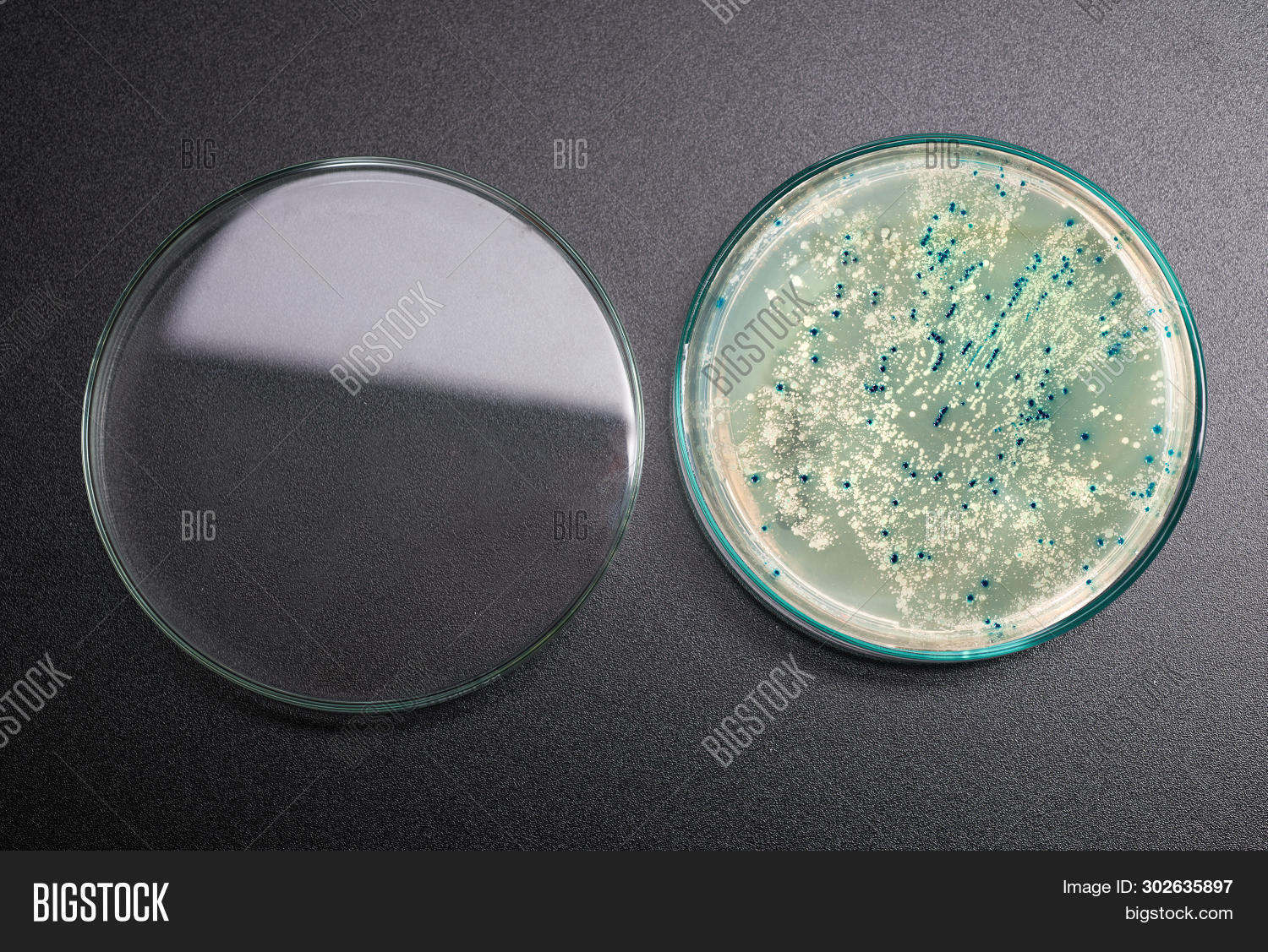 Open Agar Plate Image & Photo (Free Trial) | Bigstock