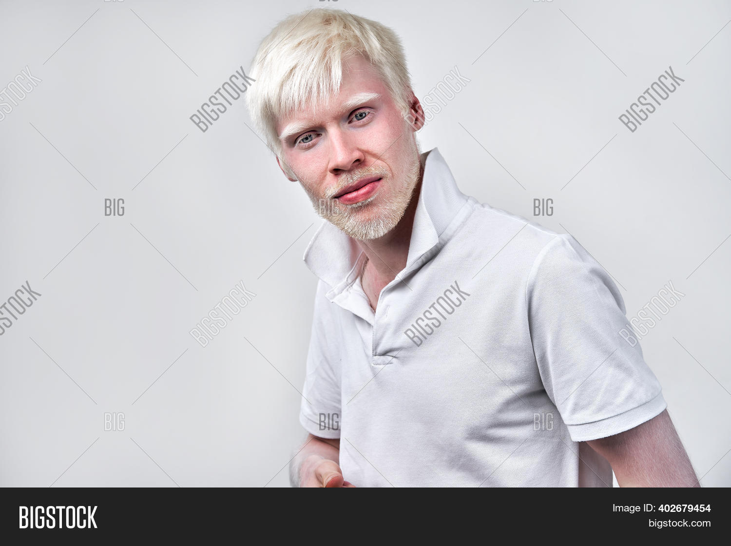 Albinism Albino Man Image & Photo (Free Trial) | Bigstock