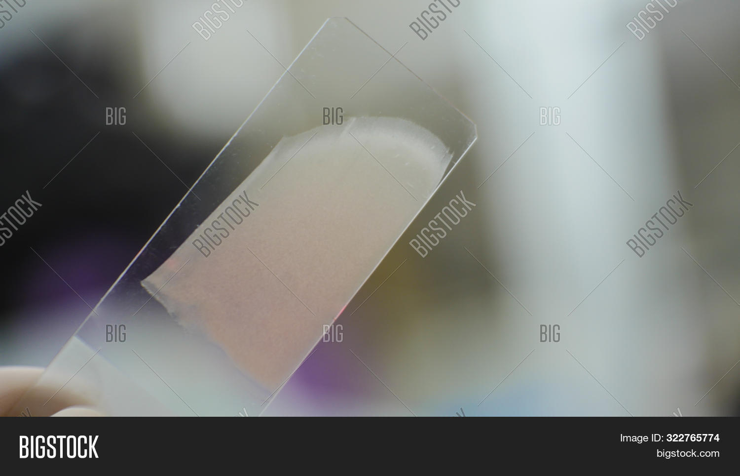 Blood Smear On Blur Image & Photo (Free Trial) | Bigstock