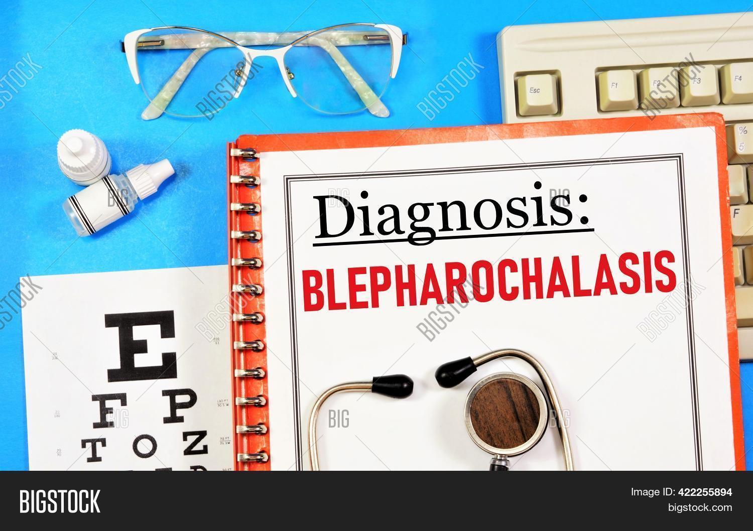 Blepharochalasis. Text Image & Photo (Free Trial) | Bigstock