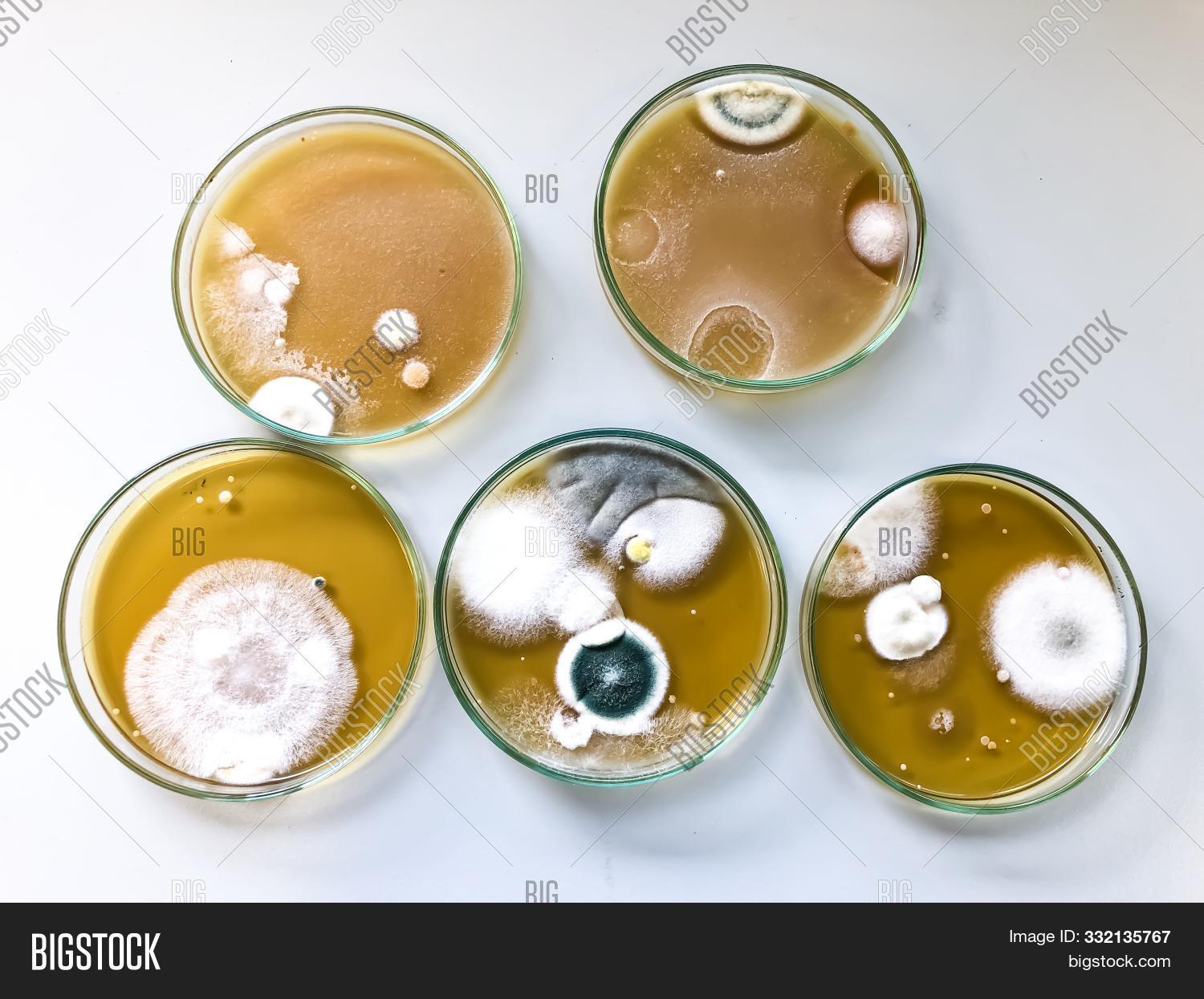 Malt Extract Agar Image & Photo (Free Trial) | Bigstock