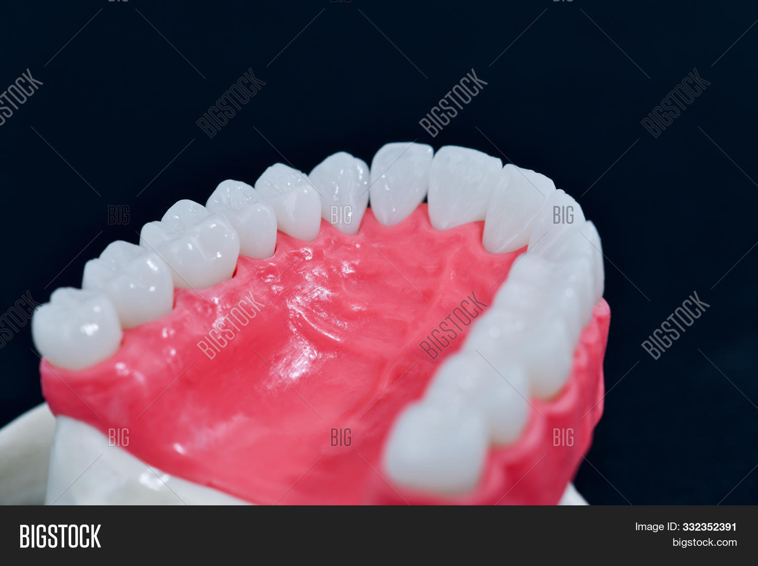 Upper Human Jaw Teeth Image & Photo (Free Trial) | Bigstock