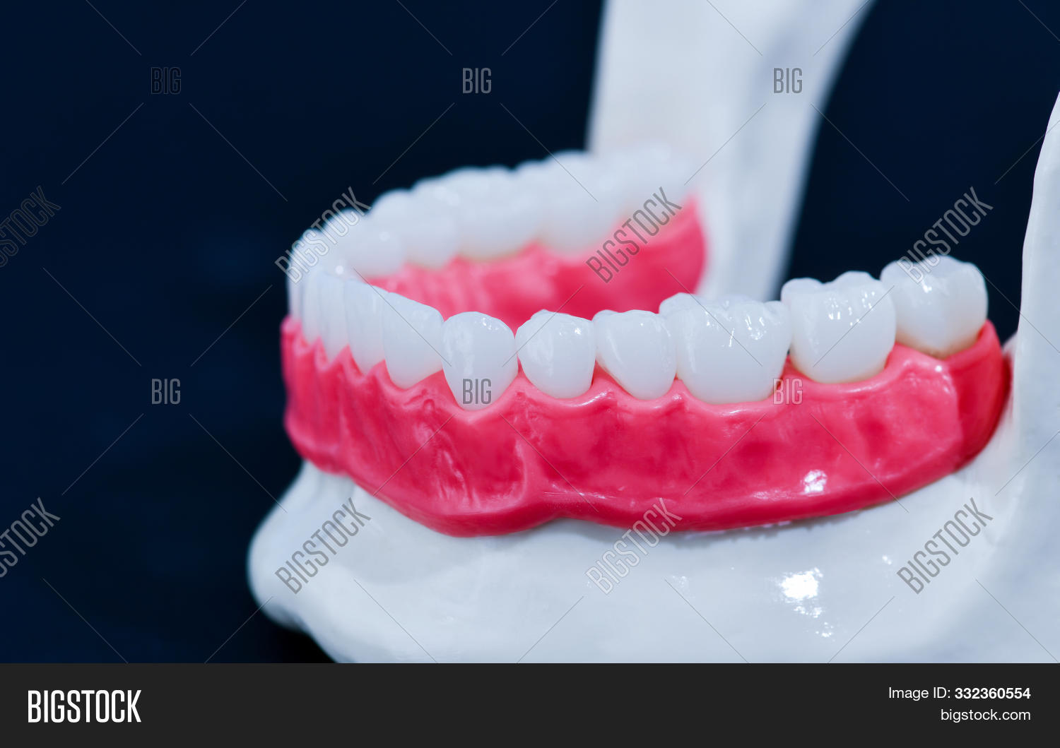 Healthy Lower Gums
