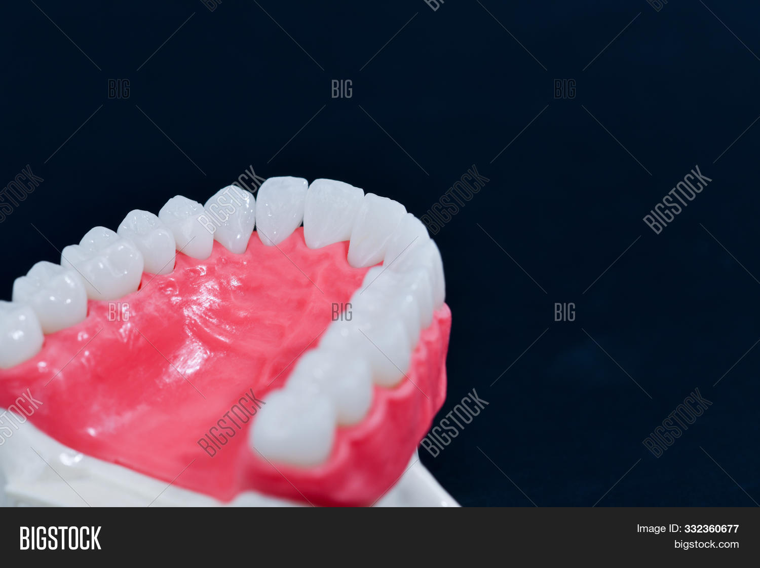 Upper Human Jaw Teeth Image & Photo (Free Trial) | Bigstock