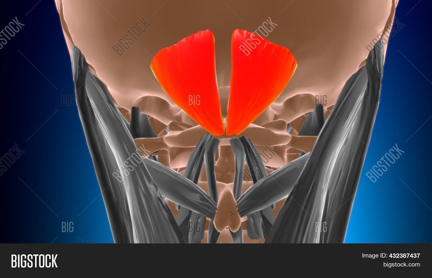 Rectus Capitis Image & Photo (Free Trial) | Bigstock