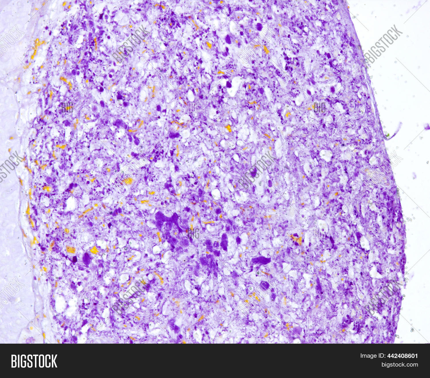 Neurohypophysis. Image & Photo (Free Trial) | Bigstock