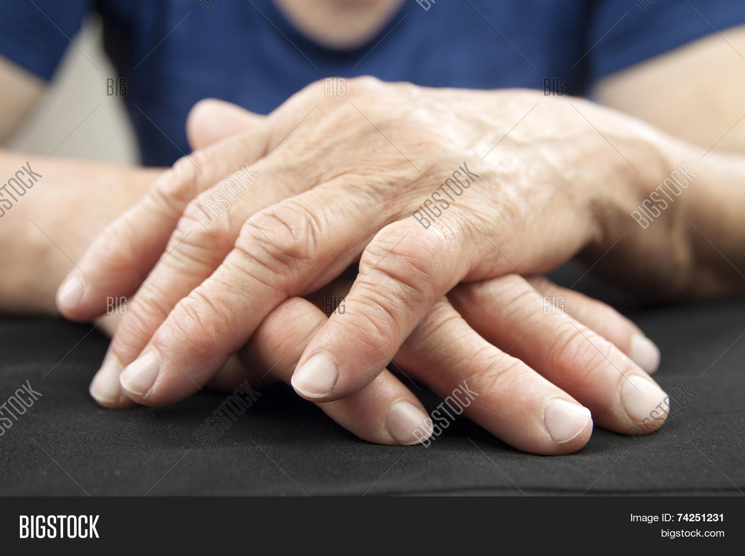 Hand Woman Deformed Image & Photo (Free Trial) | Bigstock