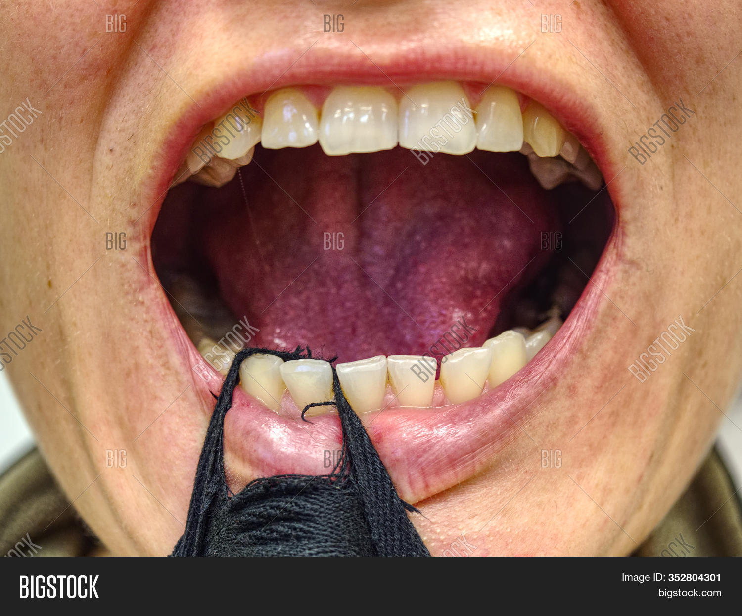 Woman Open Mouth Strip Image & Photo (Free Trial) | Bigstock