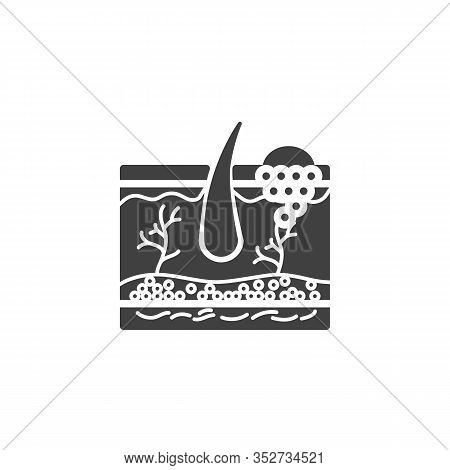 Melanoma Skin Cancer Vector & Photo (Free Trial) | Bigstock