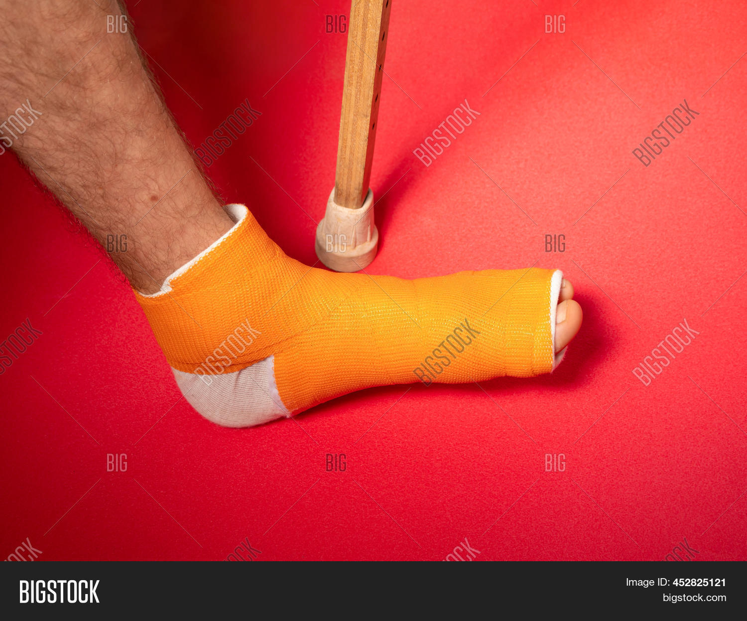 Foot Broken Toe Bone Image & Photo (Free Trial) | Bigstock