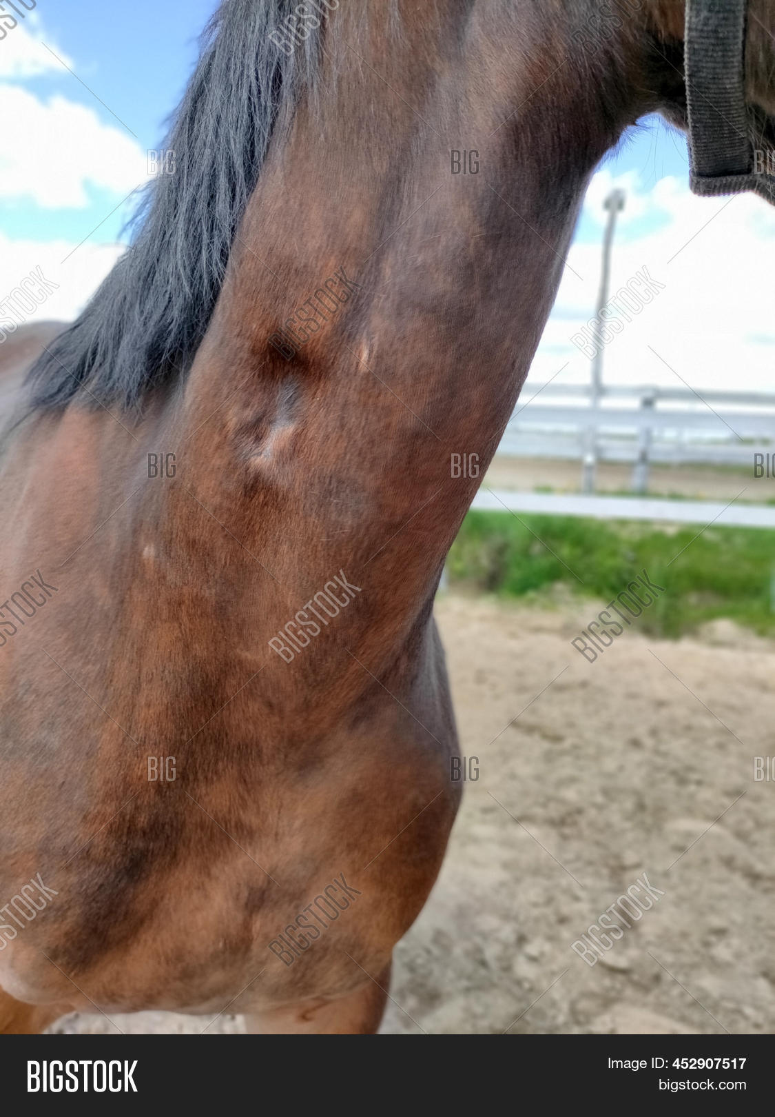 Muscle Atrophy Visible Image & Photo (Free Trial) | Bigstock