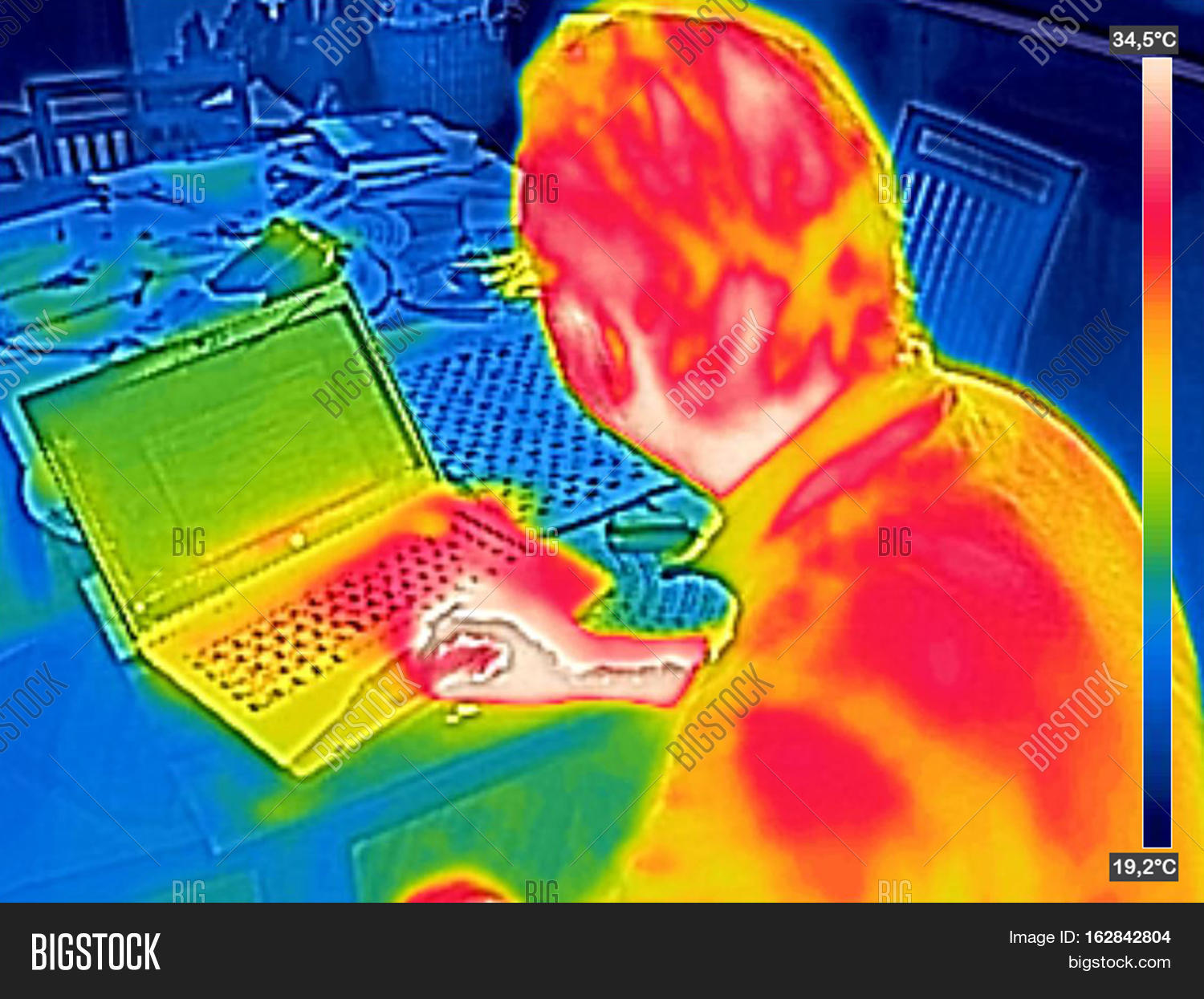 Infrared Thermography Image & Photo (Free Trial) | Bigstock