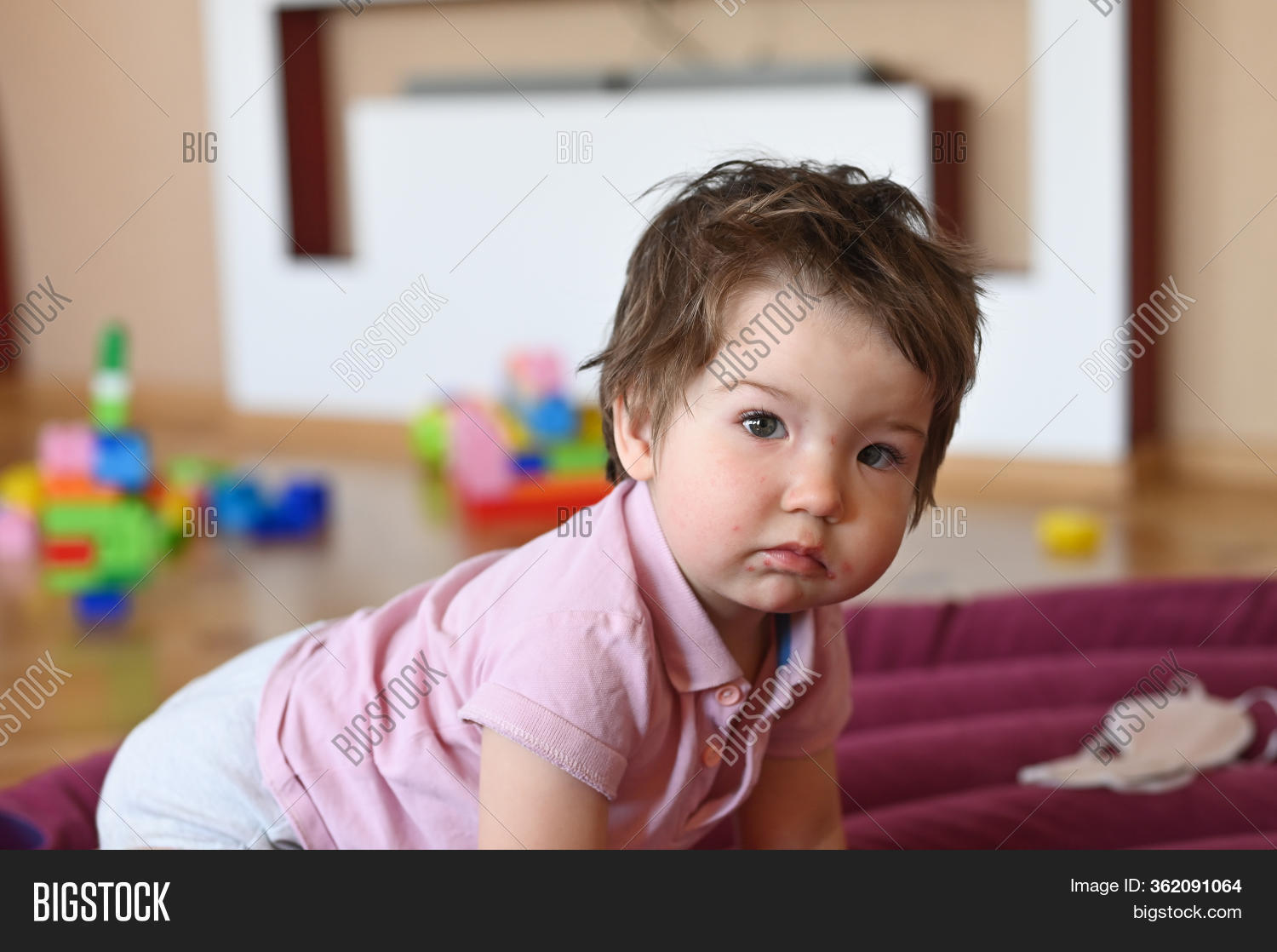 Herpes Child. Child Image & Photo (Free Trial) | Bigstock