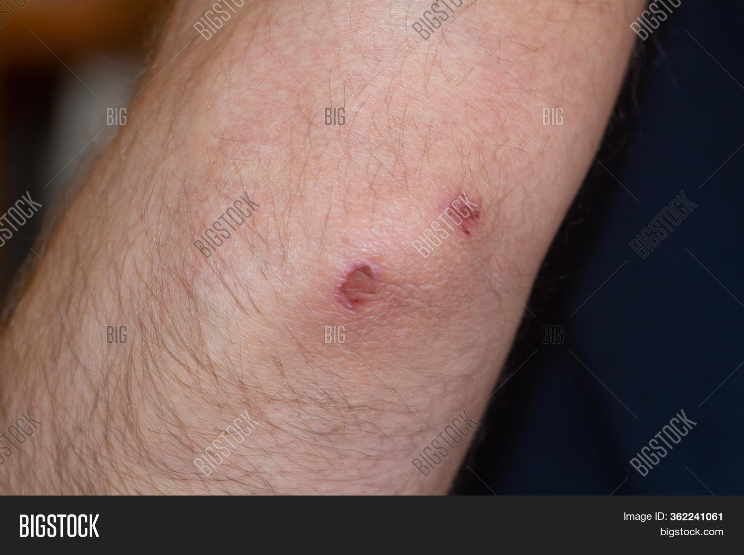 Close- Elbow Man Image & Photo (Free Trial) | Bigstock