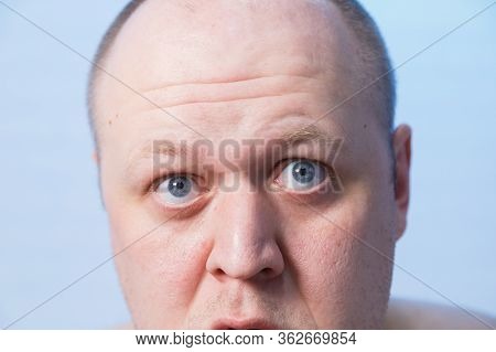 Portrait Bald Man Who Image & Photo (Free Trial) | Bigstock
