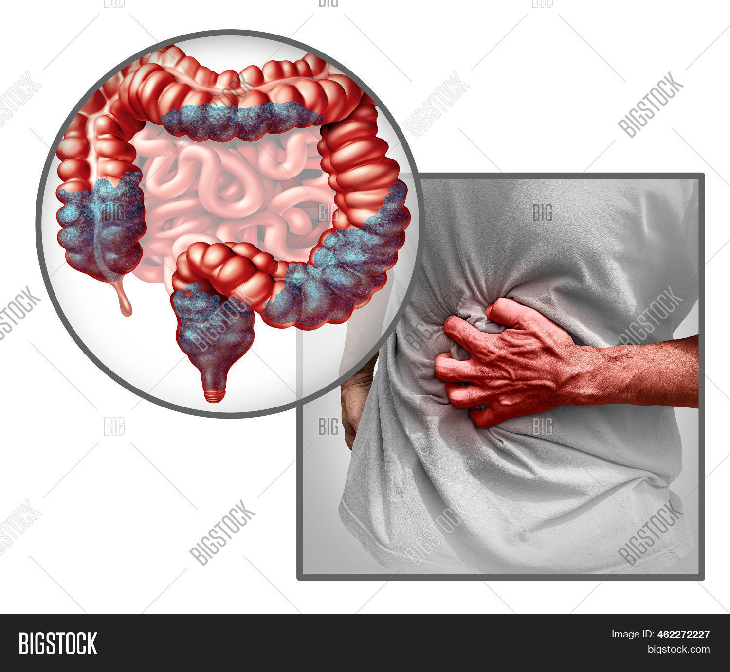 Constipation Anatomy Image & Photo (Free Trial) | Bigstock