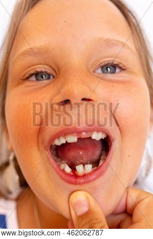 Little Girl Open Image & Photo (Free Trial) | Bigstock