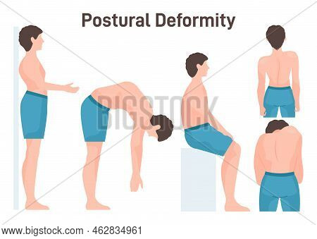 Postural Deformity. Vector & Photo (Free Trial) | Bigstock