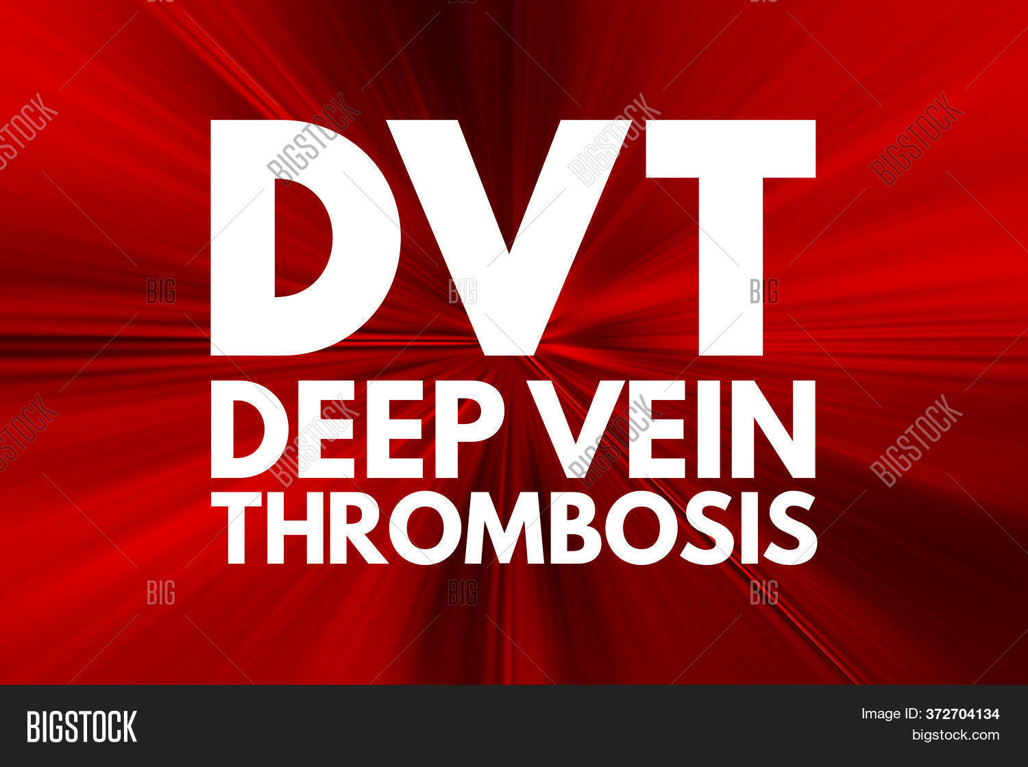 Dvt - Deep Vein Image & Photo (Free Trial) | Bigstock