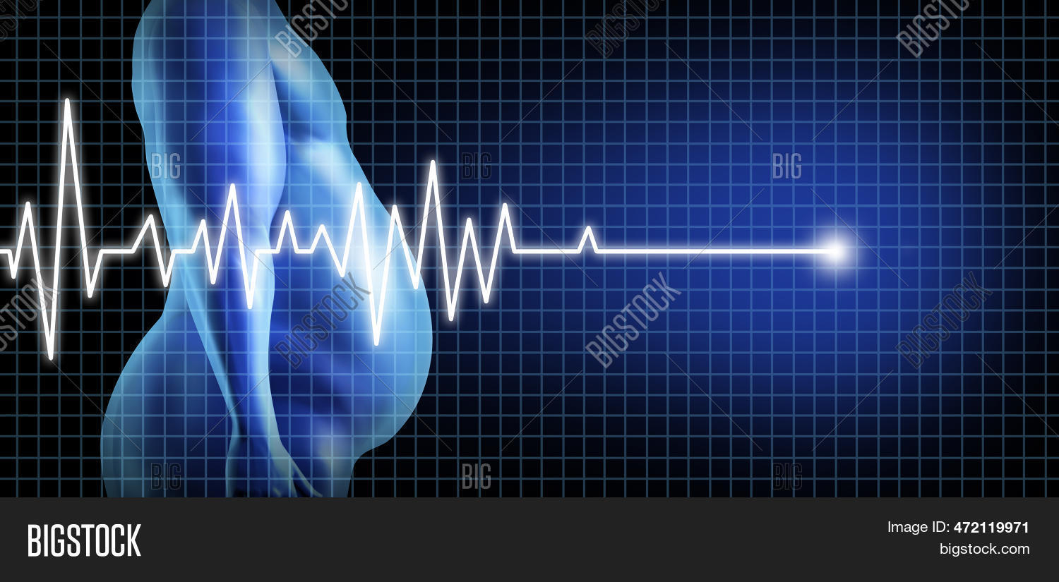 Obesity Death Risk Image & Photo (Free Trial) | Bigstock