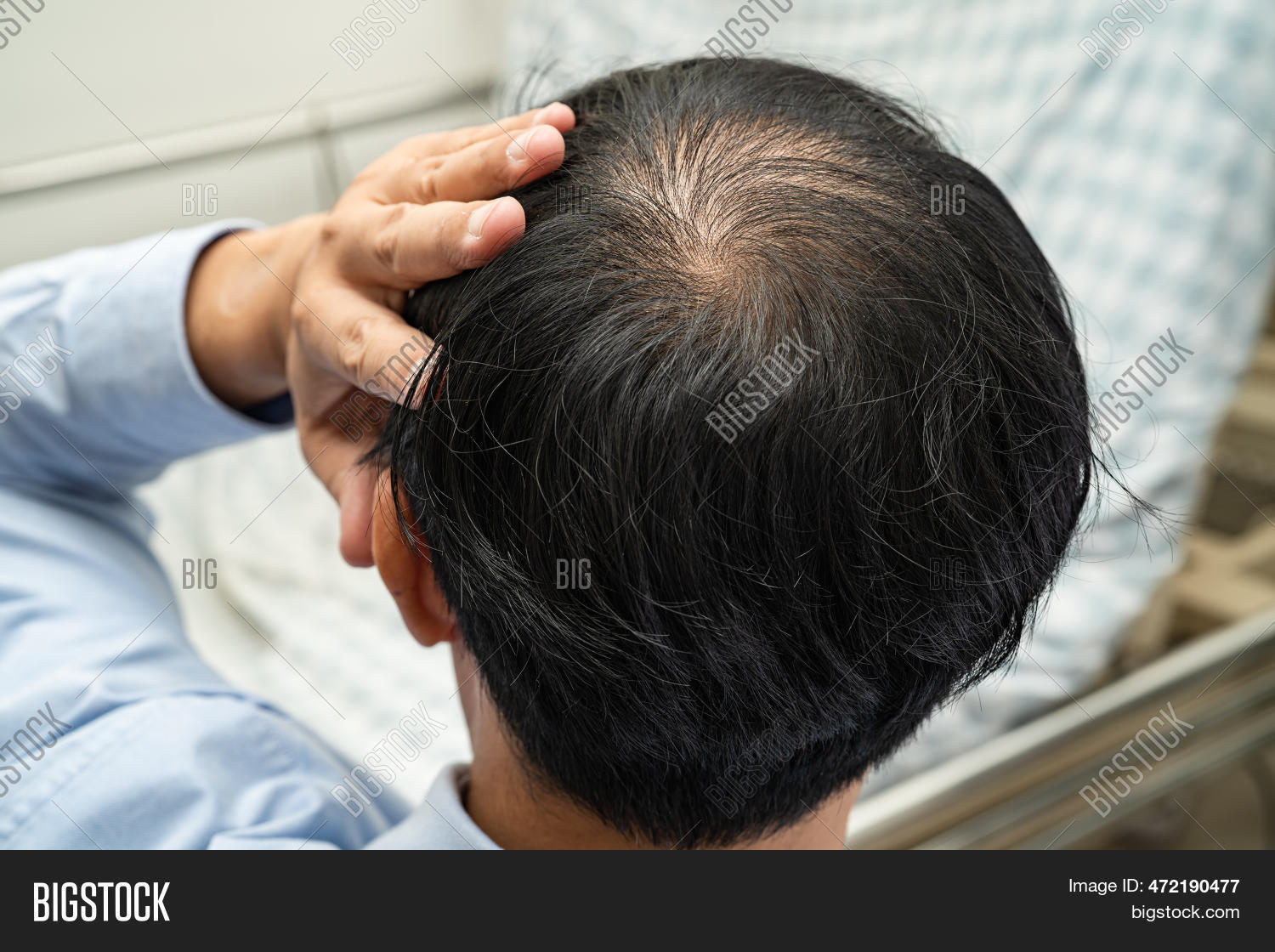 Bald Middle Head Begin Image & Photo (Free Trial) | Bigstock