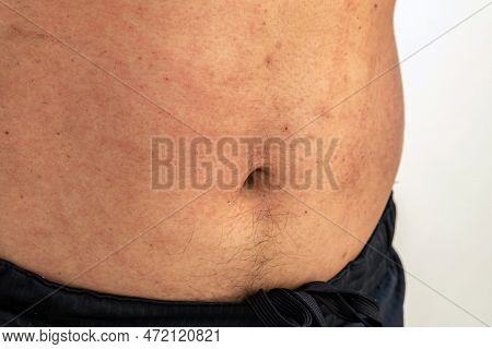 Itchy Body Rash Caused Image & Photo (Free Trial) | Bigstock