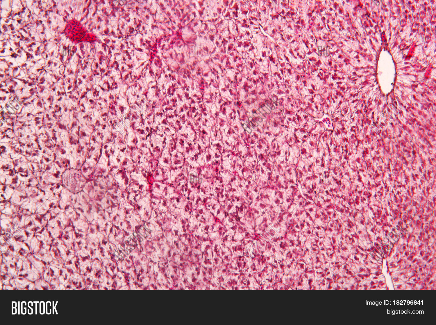 Liver Animal Tissue Image & Photo (Free Trial) | Bigstock