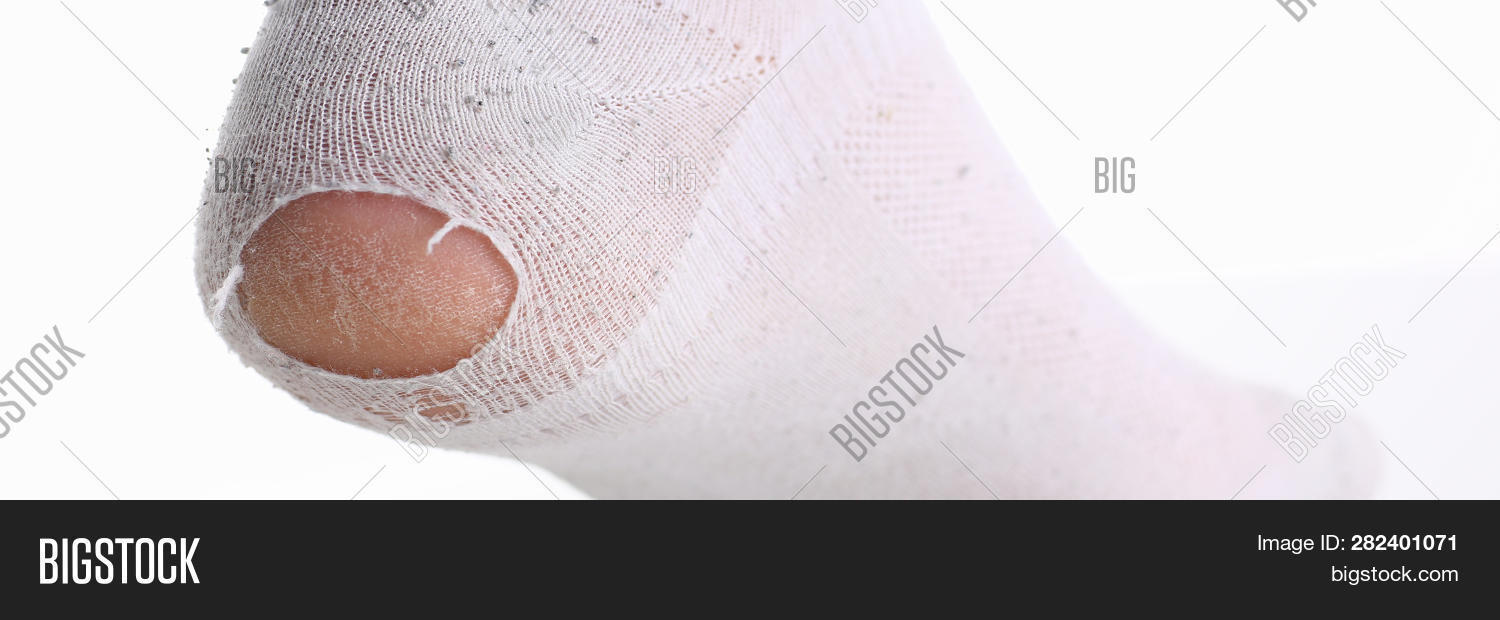 Ripped White Sock On Image & Photo (Free Trial) | Bigstock