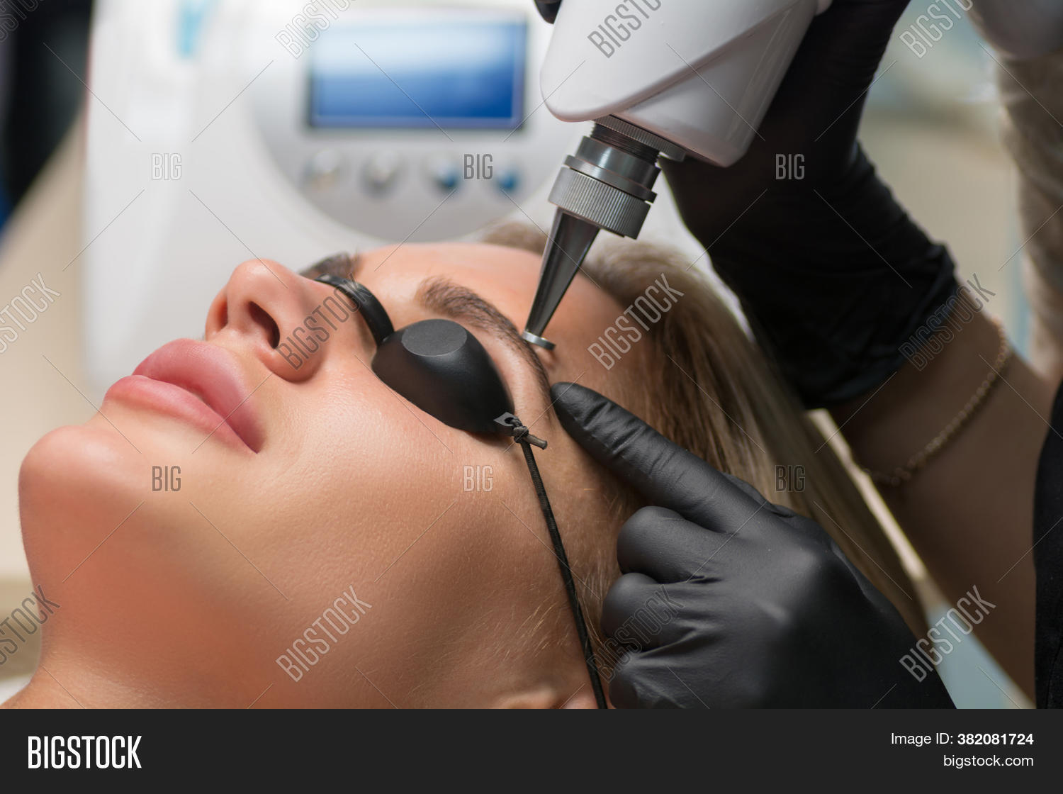 Laser Removal Image & Photo (Free Trial) | Bigstock