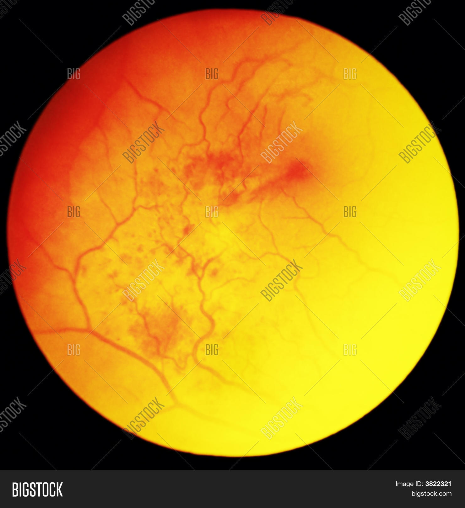 Eye Under Microscope Image & Photo (Free Trial) | Bigstock