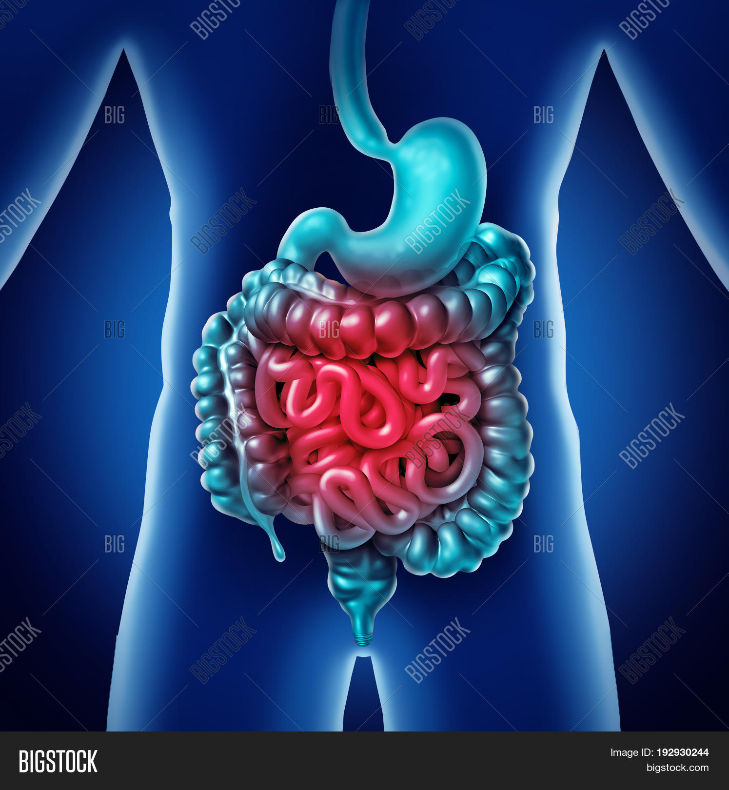 Intestine Pain Image & Photo (Free Trial) | Bigstock