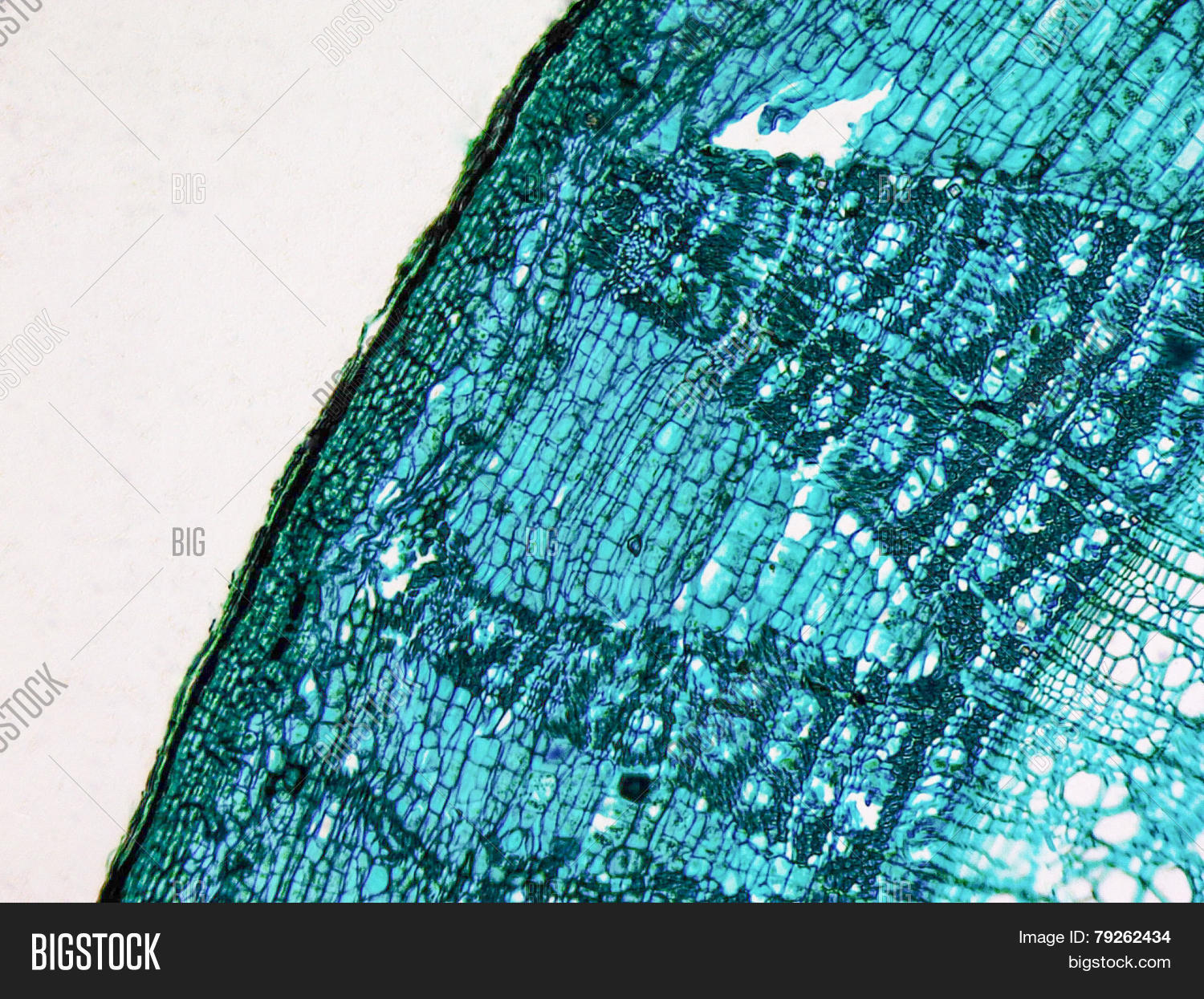 Tilia Stem Micrograph Image & Photo (Free Trial) | Bigstock